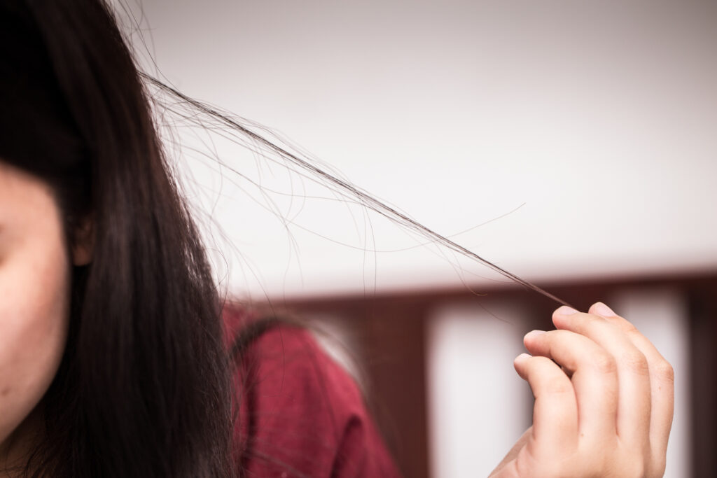 Trichotillomania Explained: Symptoms & Treatments