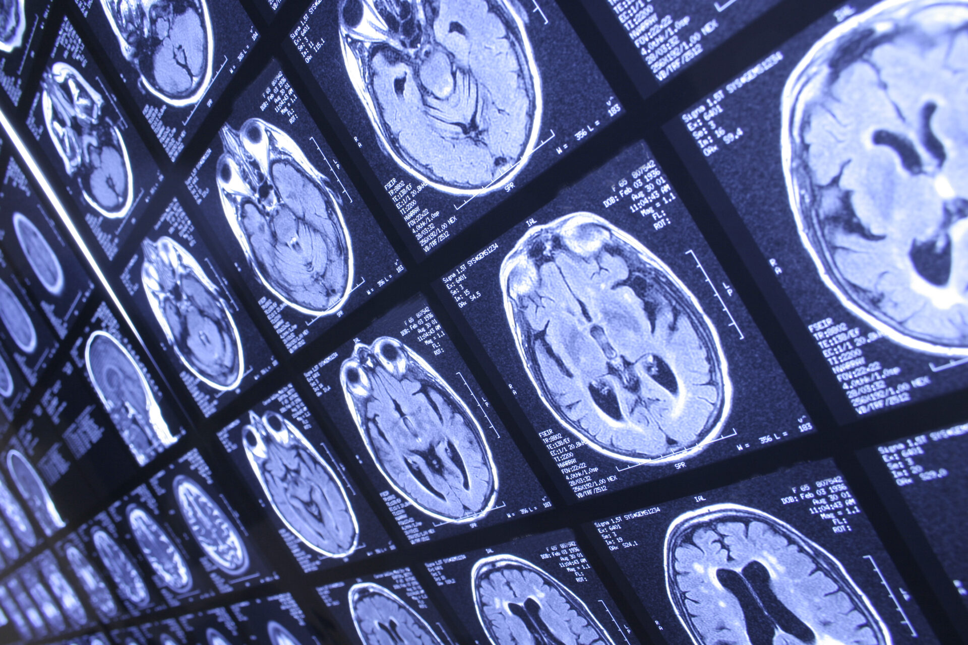 Healthy Brain Network's Impact - Child Mind Institute